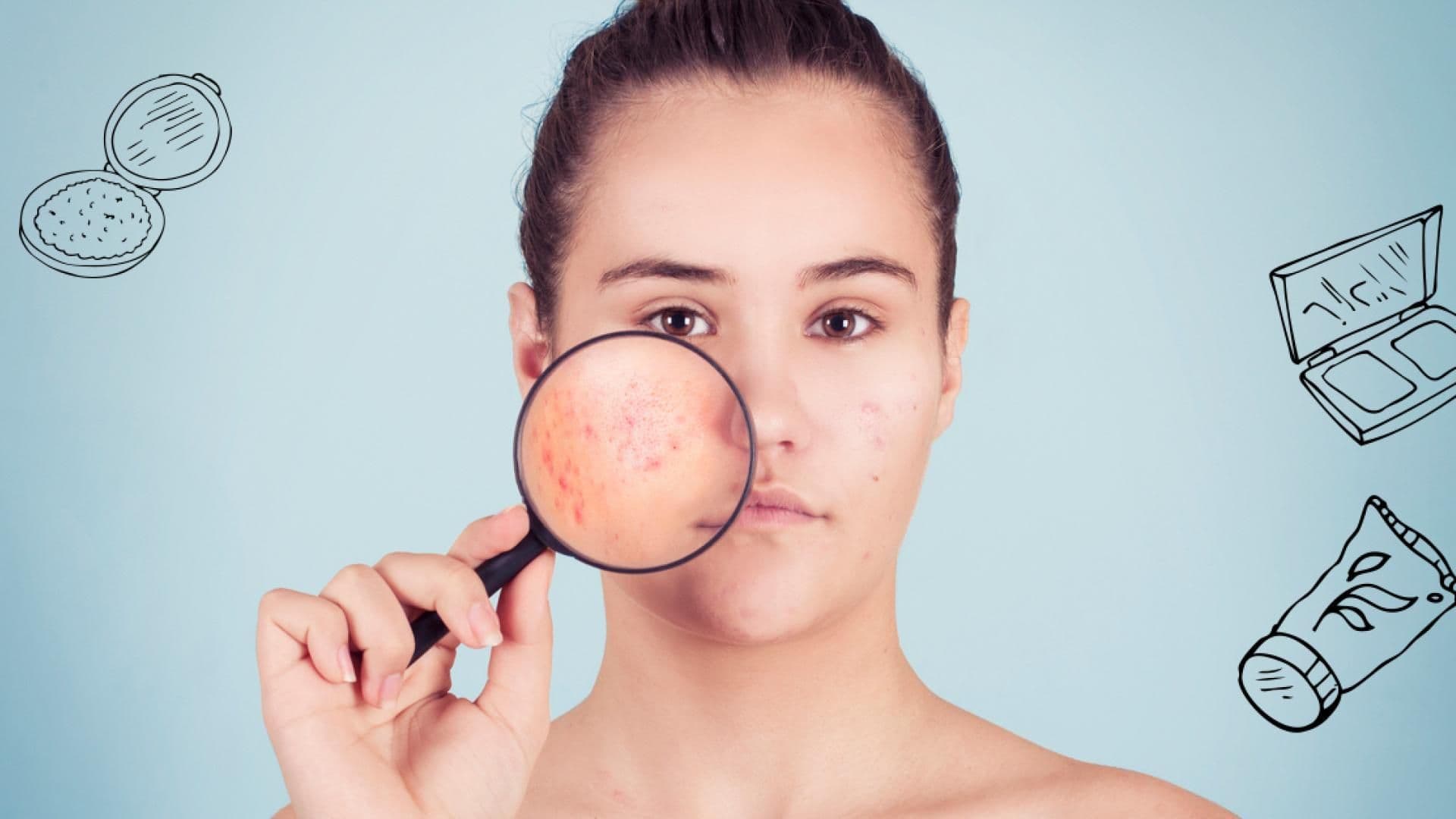Acne inversa: Das wünschst Du nicht mal Deinem größten Feind!