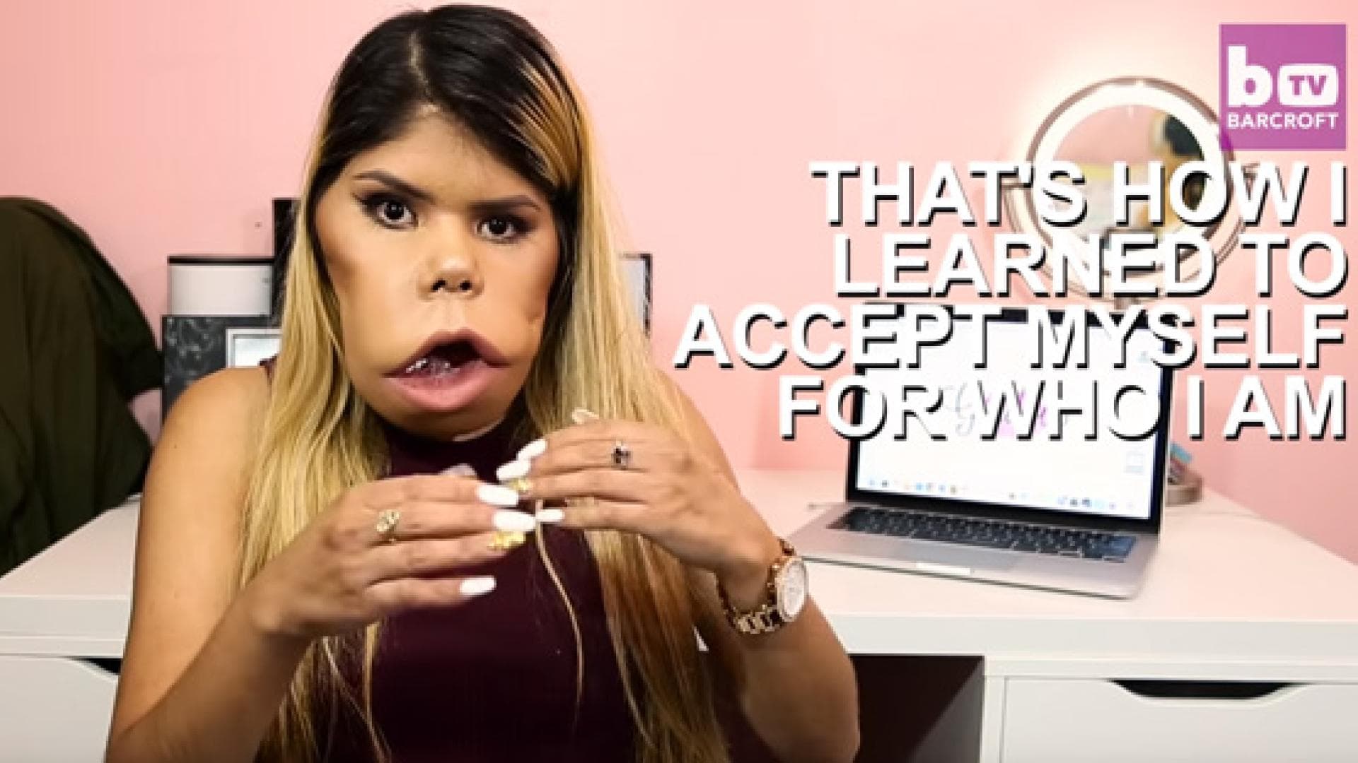 YouTuberin lebt mit Gesichtstumor