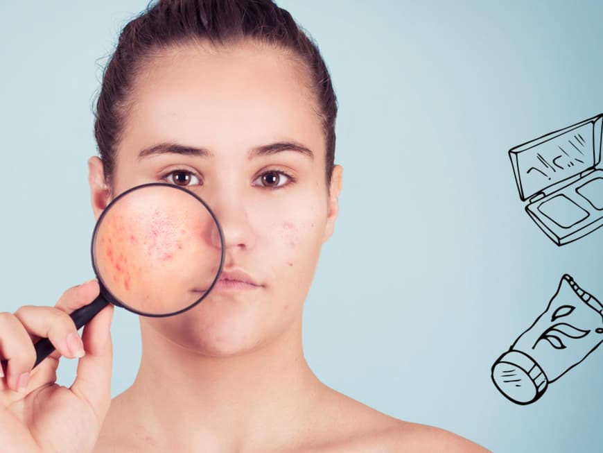Acne inversa: Das wünschst Du nicht mal Deinem größten Feind!